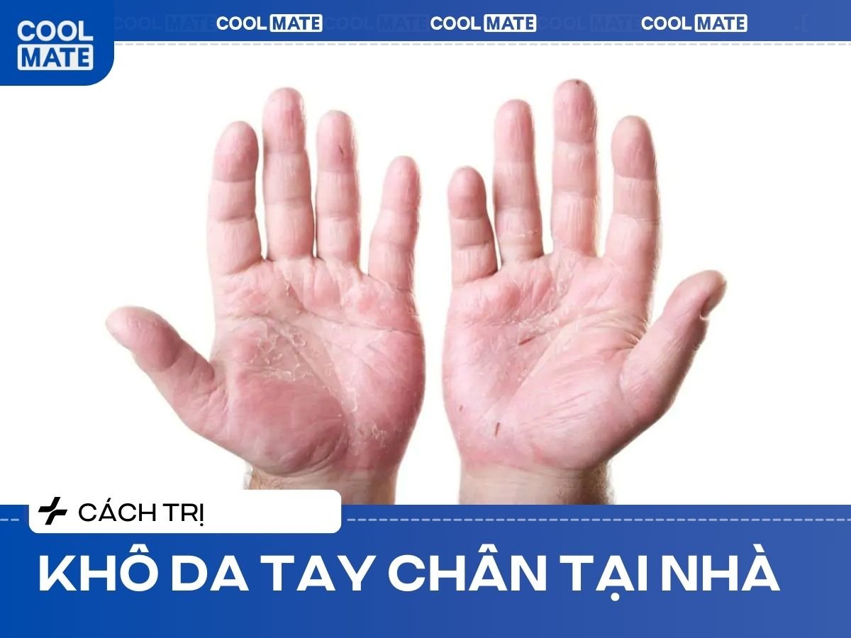 Cách trị khô da tay chân tại nhà đơn giản mà vô cùng hiệu quả ...